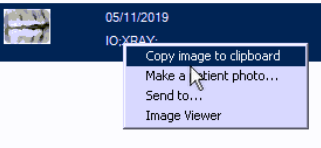 Sending X-Rays via Email – EXACT Help Centre