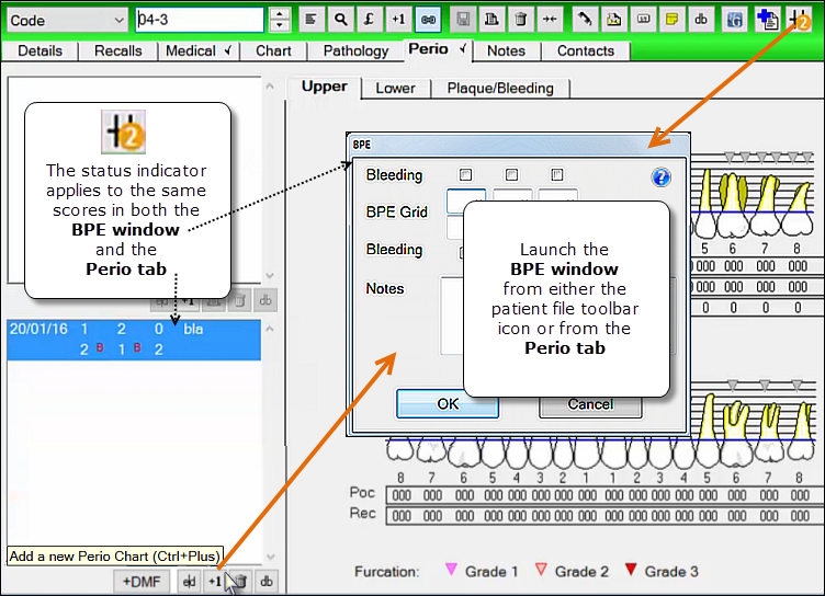 Recording a BPE – EXACT Help Centre