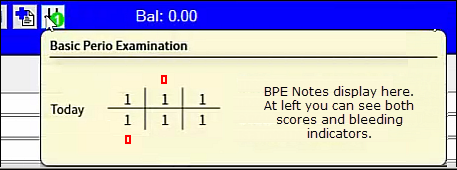 Recording a BPE – EXACT Help Centre