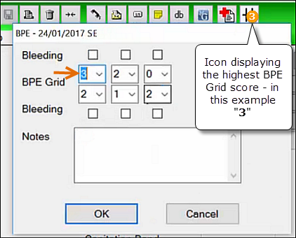 Recording a BPE – EXACT Help Centre